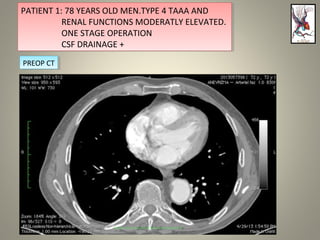 Visceral debranching for the treatment of taaa | PPT