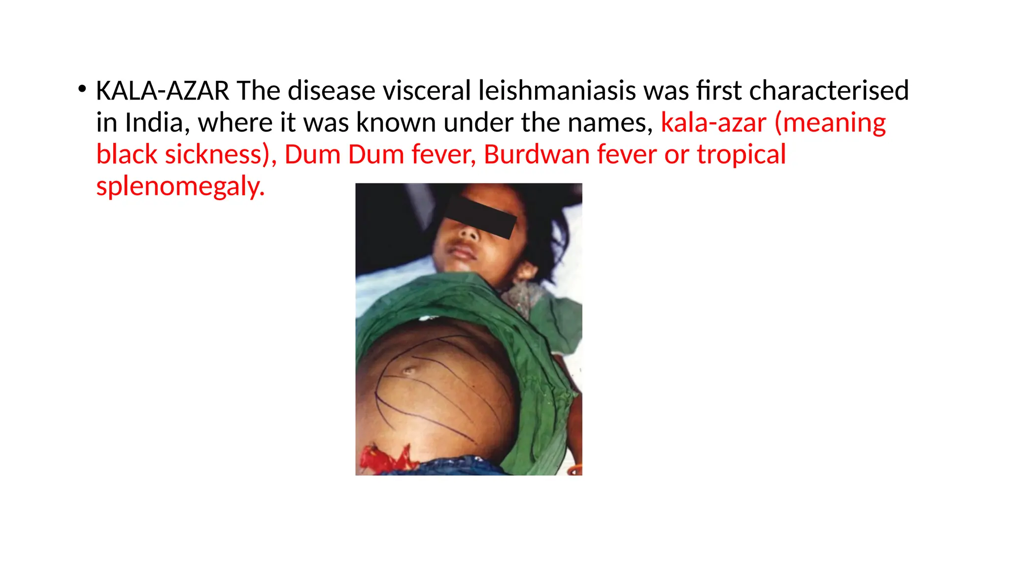 Visceral leishmaniasis(Kala-azar).presentation | PPT