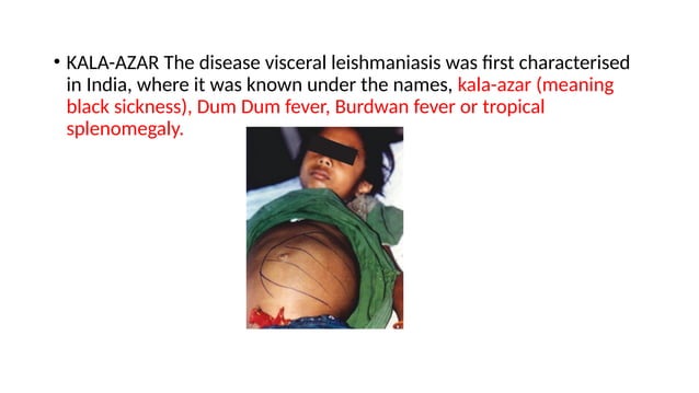 Visceral leishmaniasis(Kala-azar).presentation | PPTX | Infectious ...