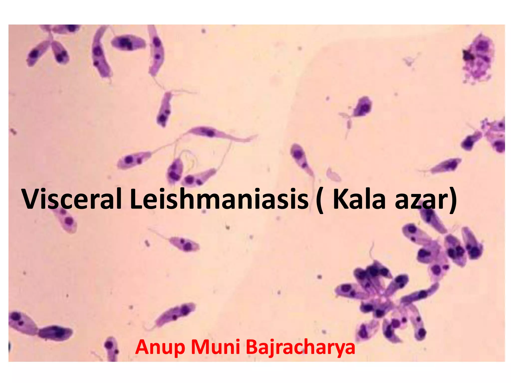 Visceral leishmaniasis ( kala azar) | PDF