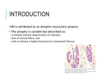 Visceral myopathy | PPTX