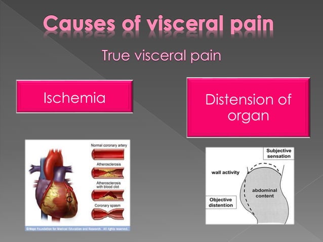 Visceral pain | PPTX