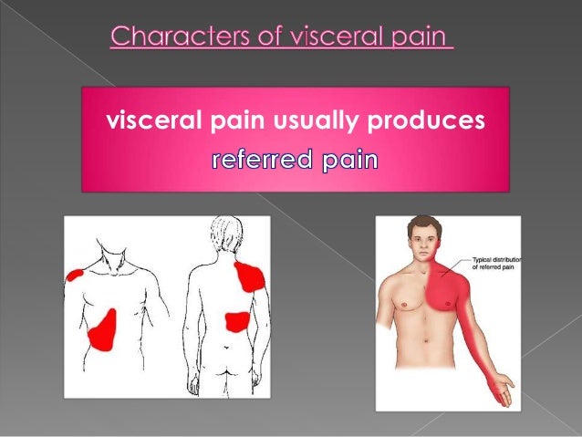 Visceral pain