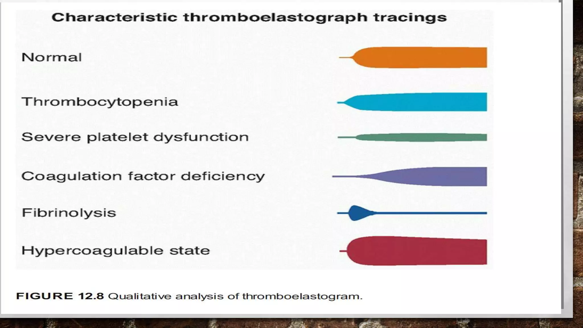 Viscoelastic point-of-care testing.pptx