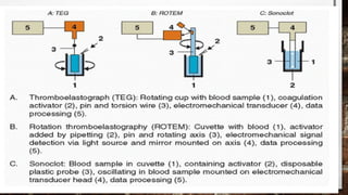 Viscoelastic point-of-care testing.pptx