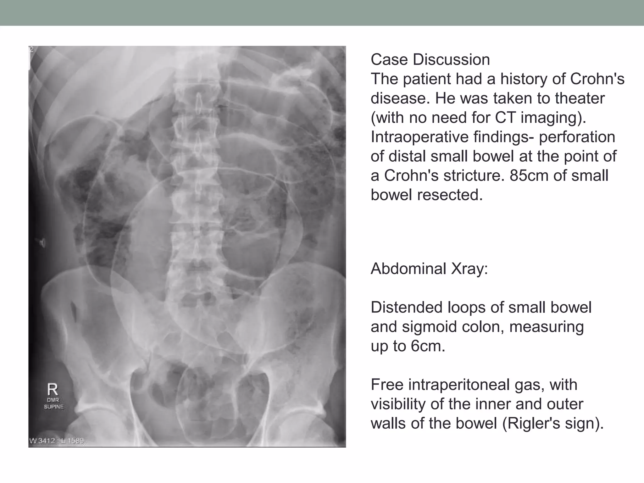 VISCUS INJURY .ppt