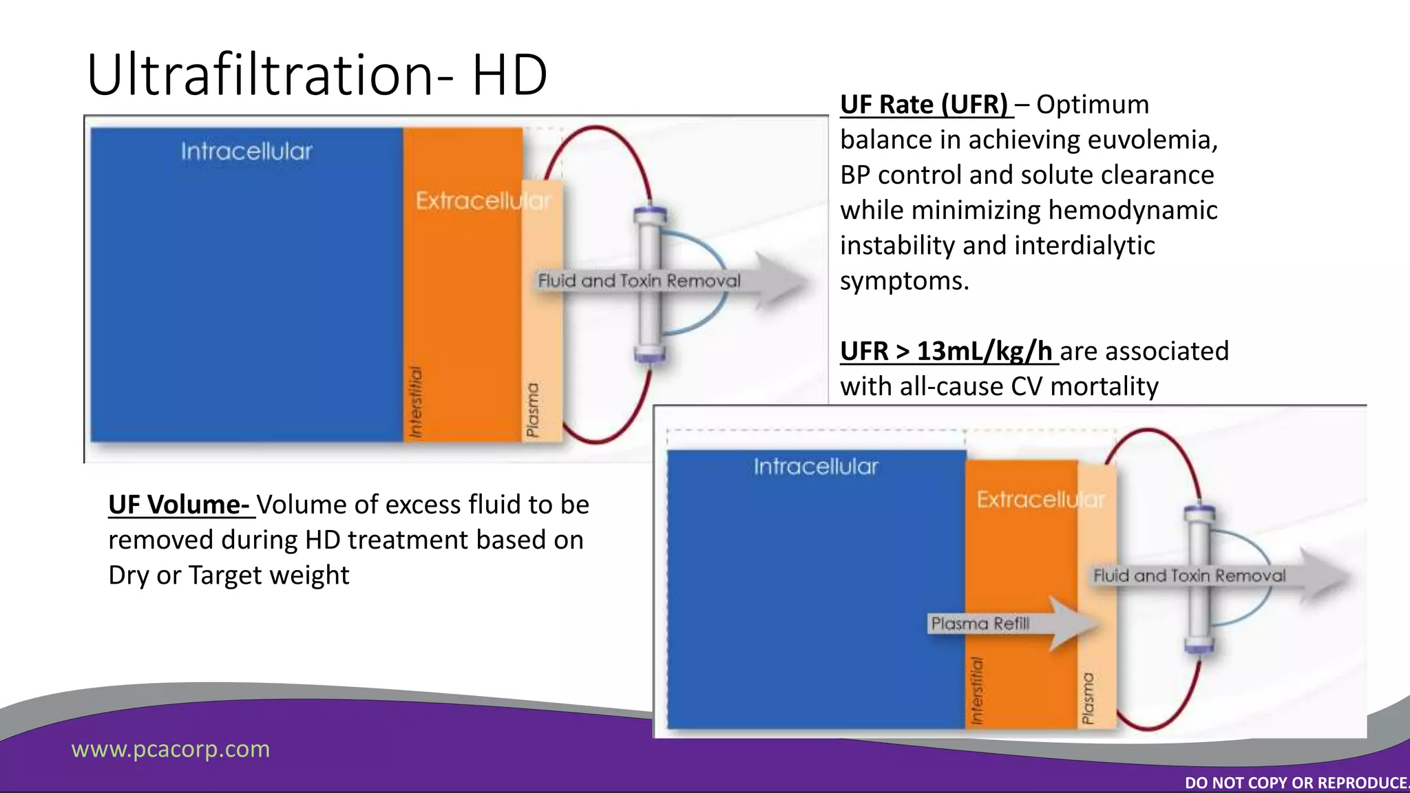 Fluid management in dialysis | PPT