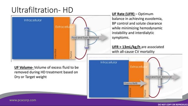 Fluid management in dialysis | PPT