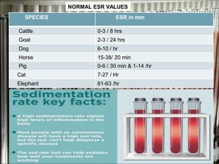METHODS OF EVALUATION OF ESR AND ITS CLINICAL SIGNIFICANCE | PPTX