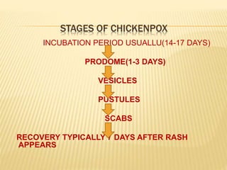 chickenpox | PPTX