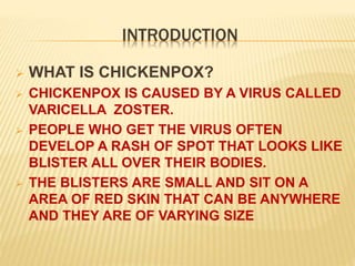 chickenpox | PPTX