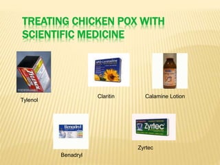 chickenpox | PPTX