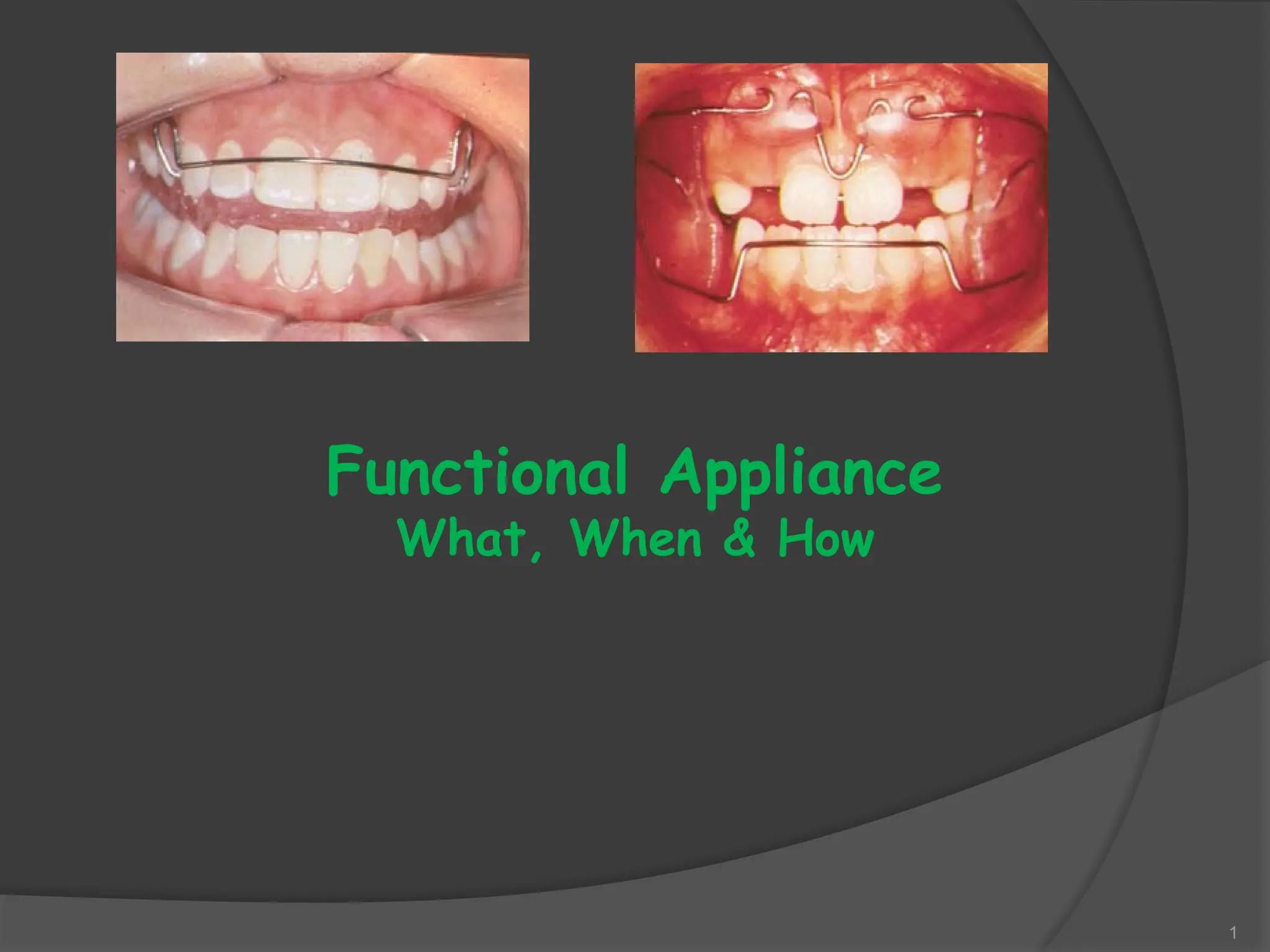 vish FUNCTIONAL APPLIANCE orthodontics.pptx