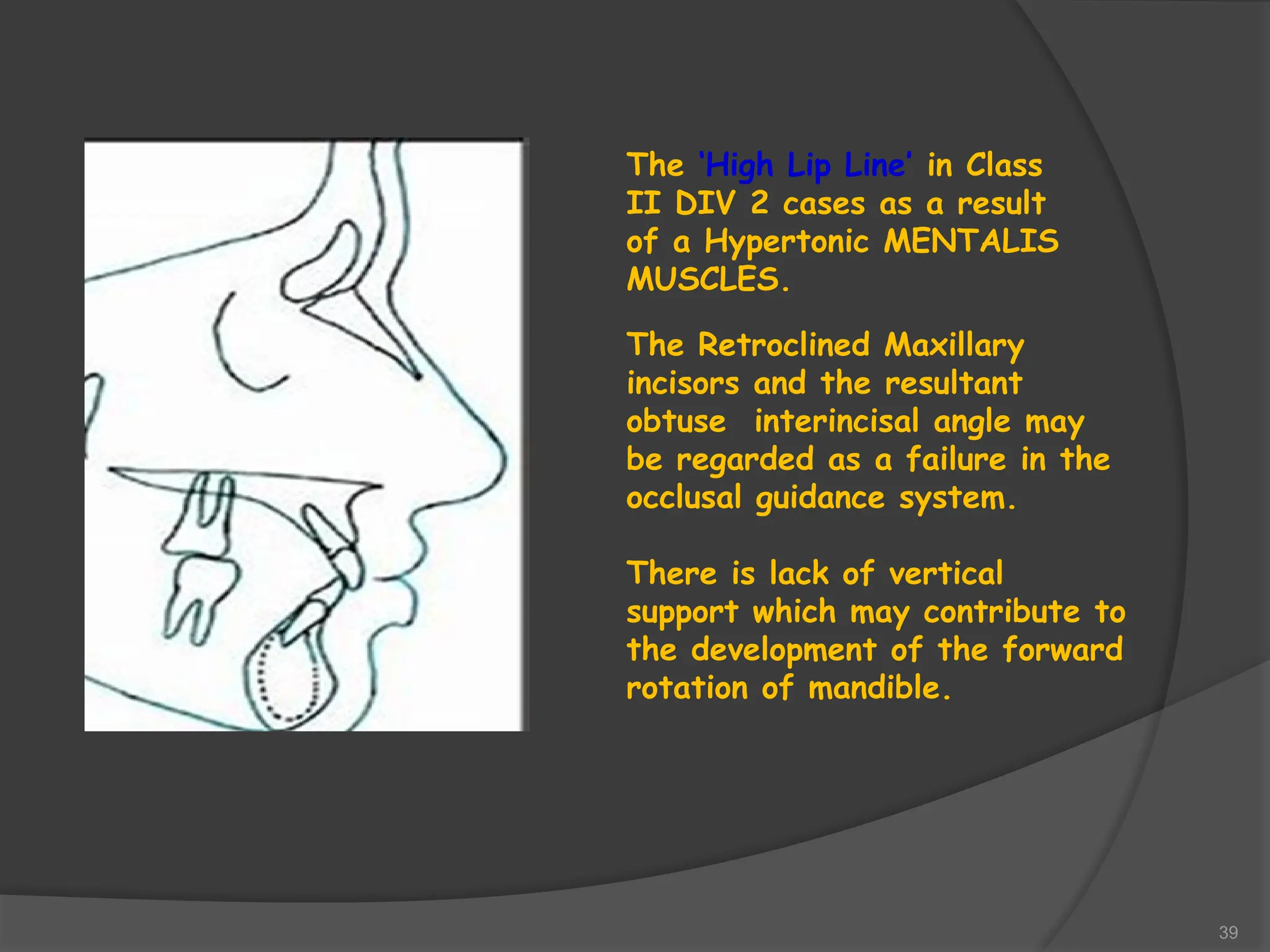vish FUNCTIONAL APPLIANCE orthodontics.pptx