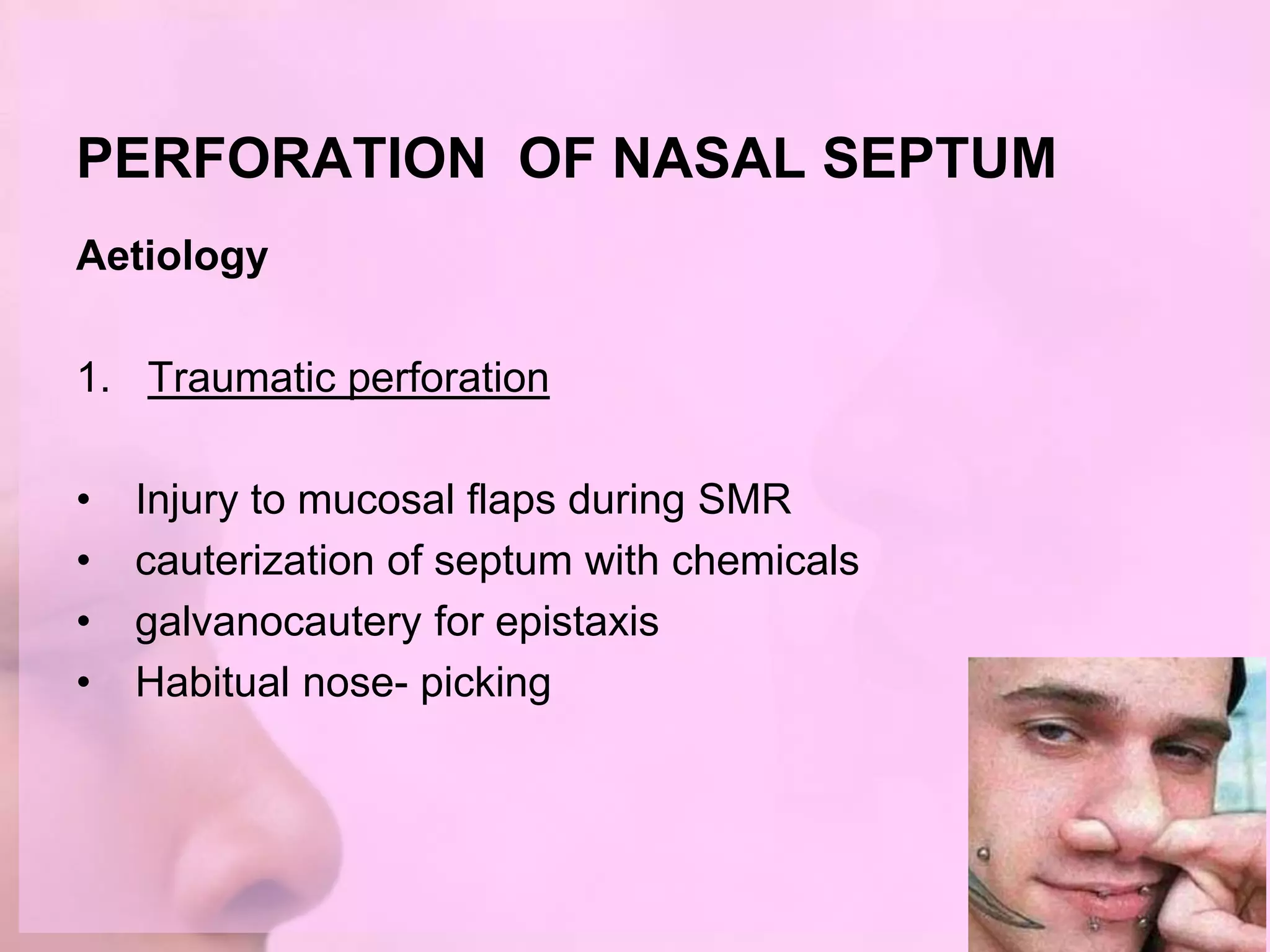 NASAL SEPTAL DISEASES | PPTX