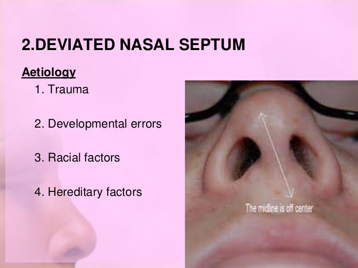 Nasal Septal Diseases