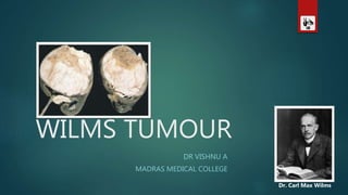 Wilm's tumour - The most common kidney tumor in children - Dr Vishnu A ...