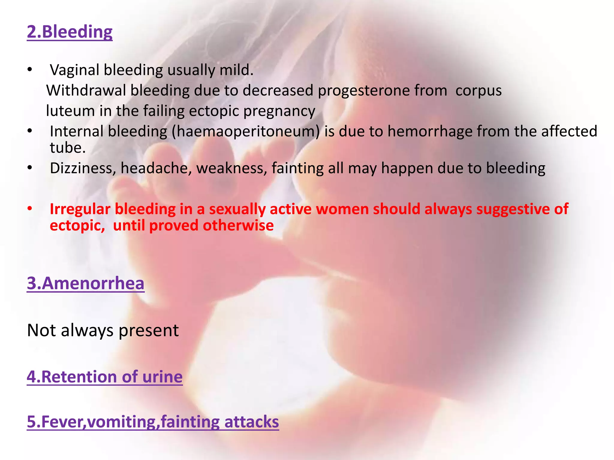 ectopic pregnancy | PPTX