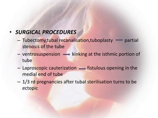 ectopic pregnancy | PPT