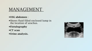 Abdominal lump pelvic mass from bailey and love | PPTX