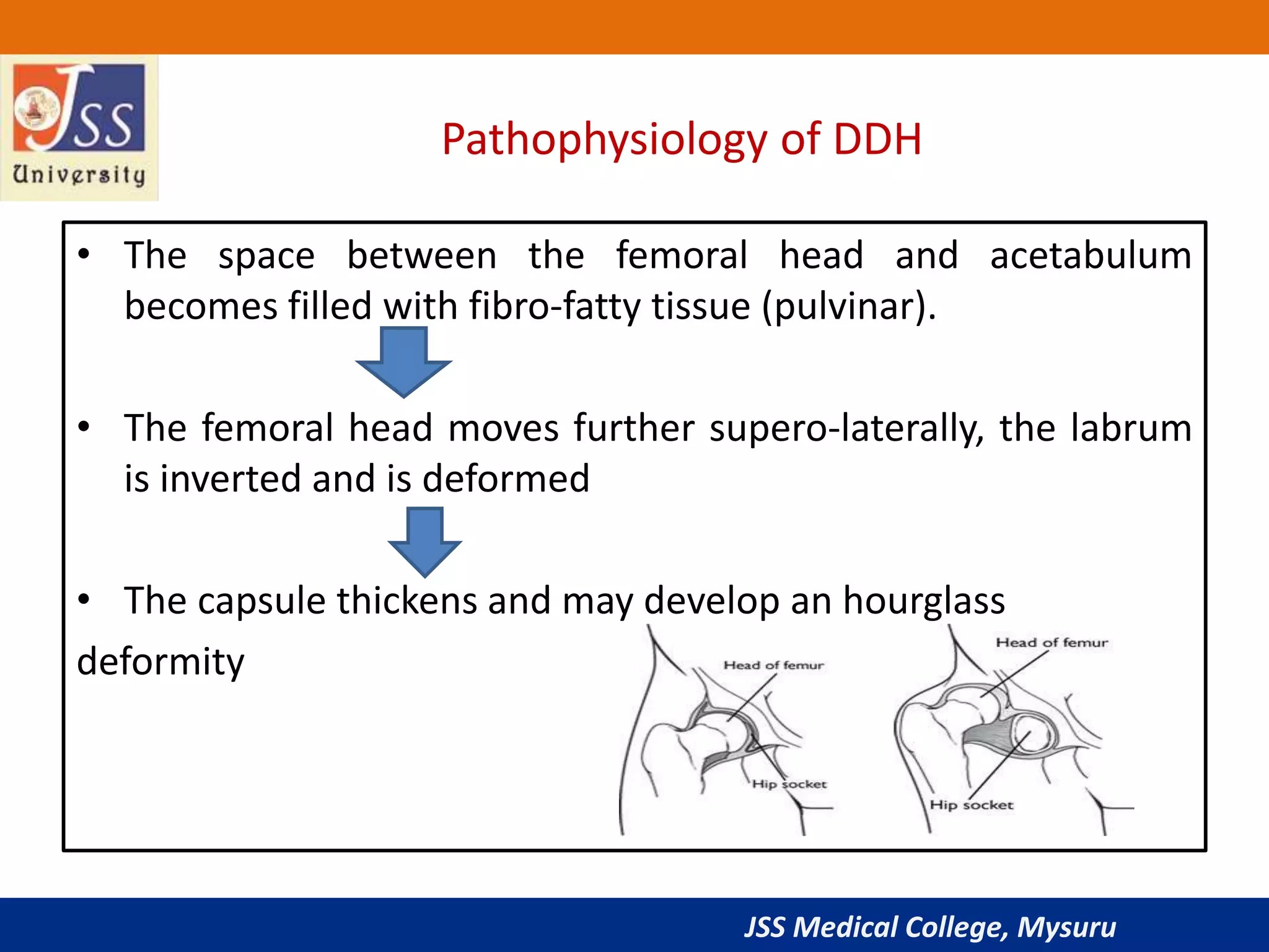 Hip ultrasonography in infants and children | PPTX