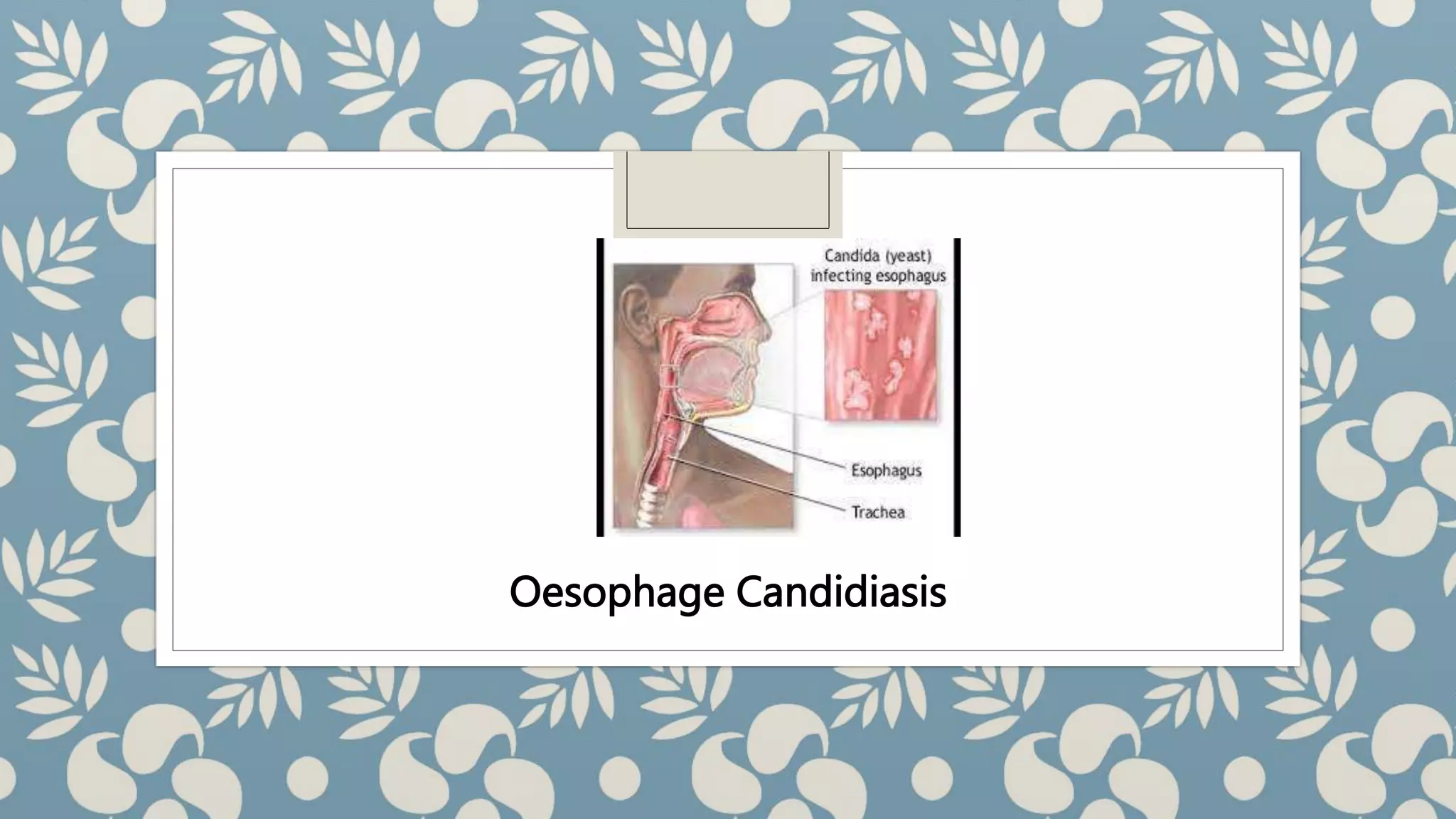 Candida Albicans | PPT