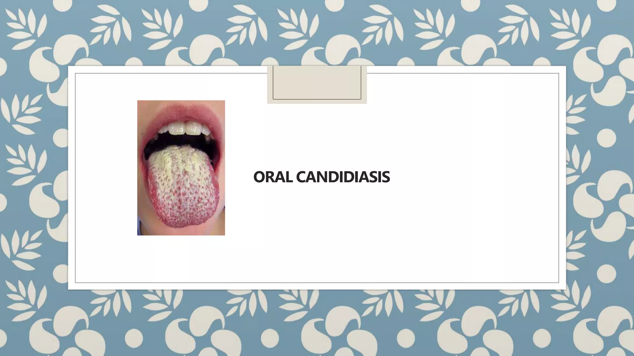 Candida Albicans | PPT