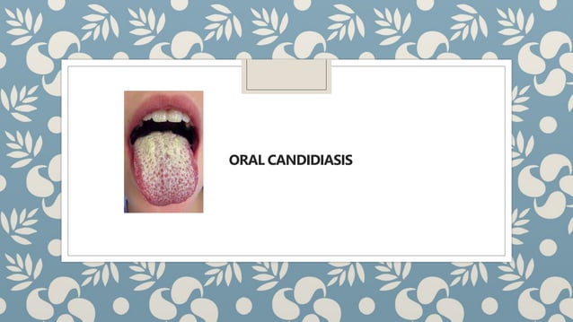 Candida Albicans | PPT