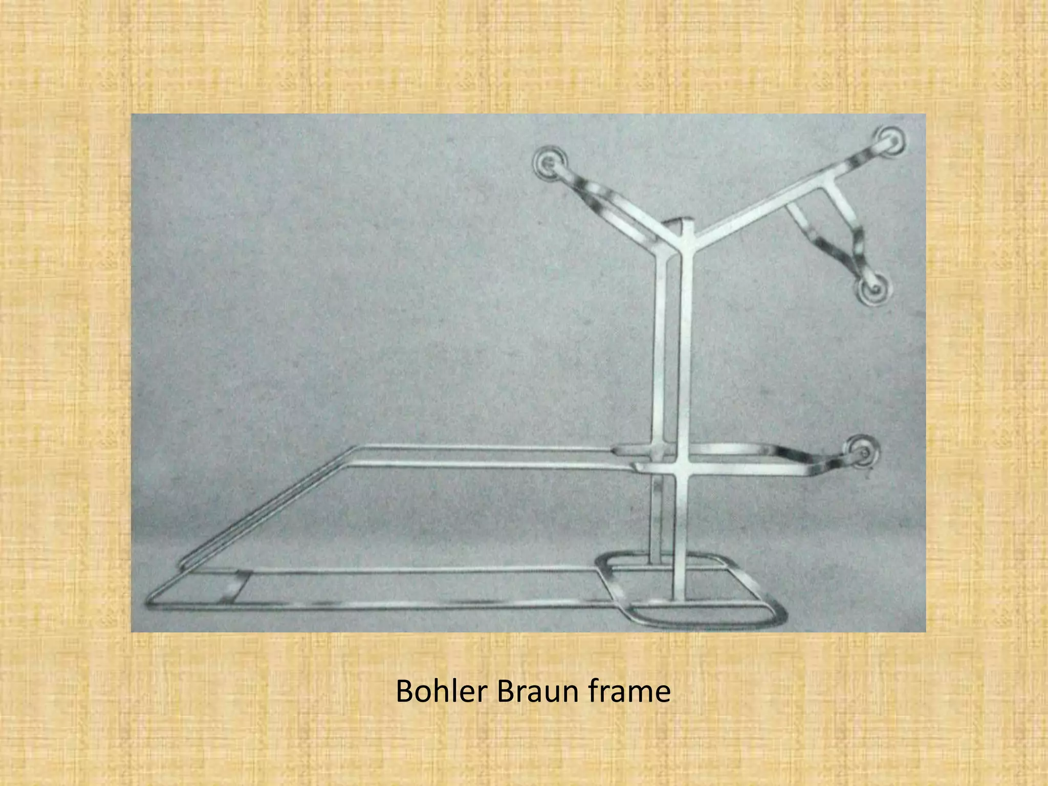 PPT ON TRACTIONS IN ORTHOPAEDICS | PPTX