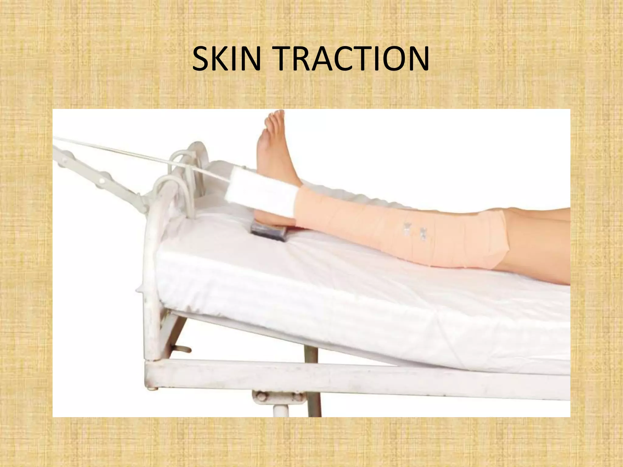 PPT ON TRACTIONS IN ORTHOPAEDICS | PPTX