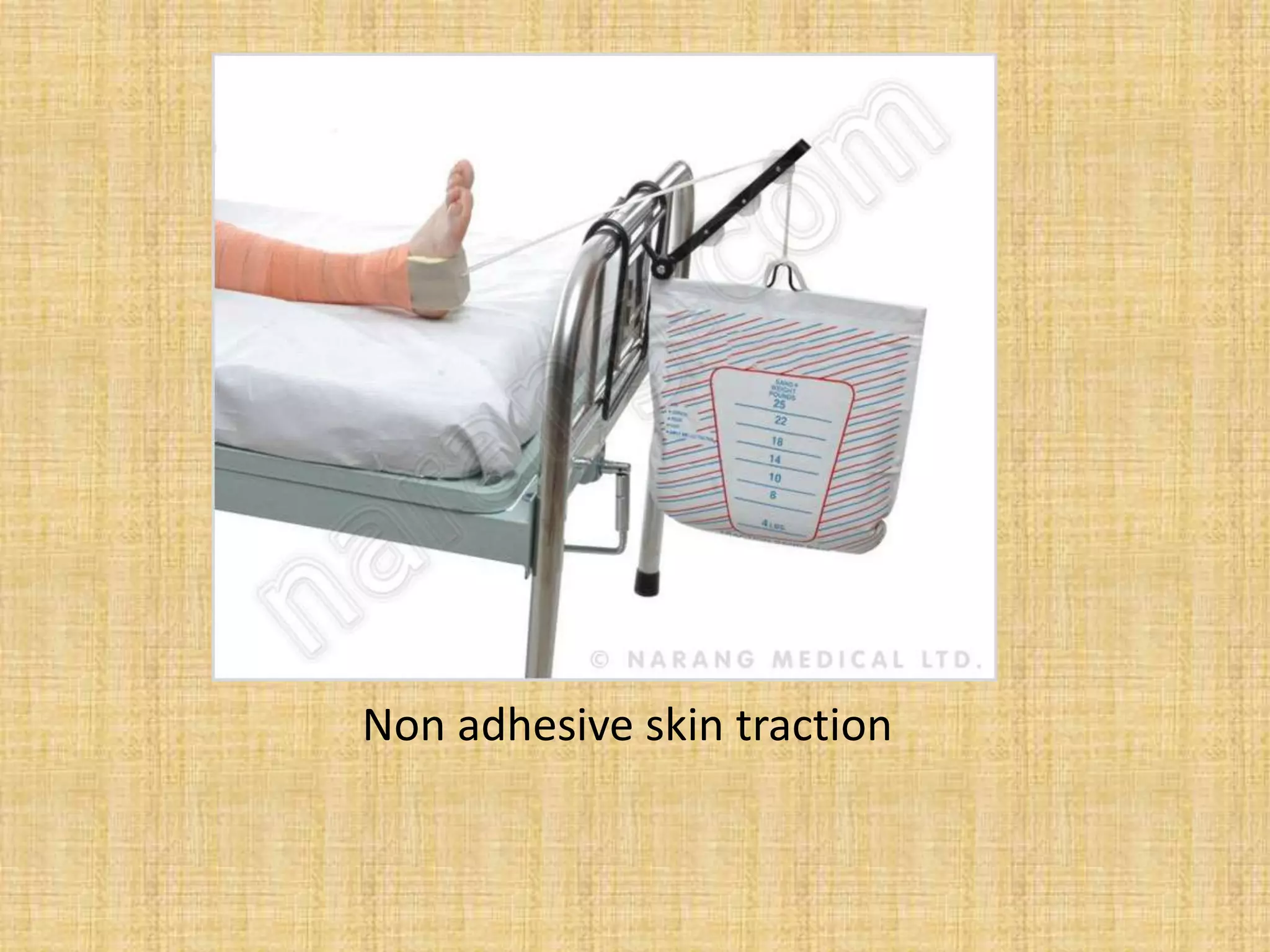 PPT ON TRACTIONS IN ORTHOPAEDICS | PPTX