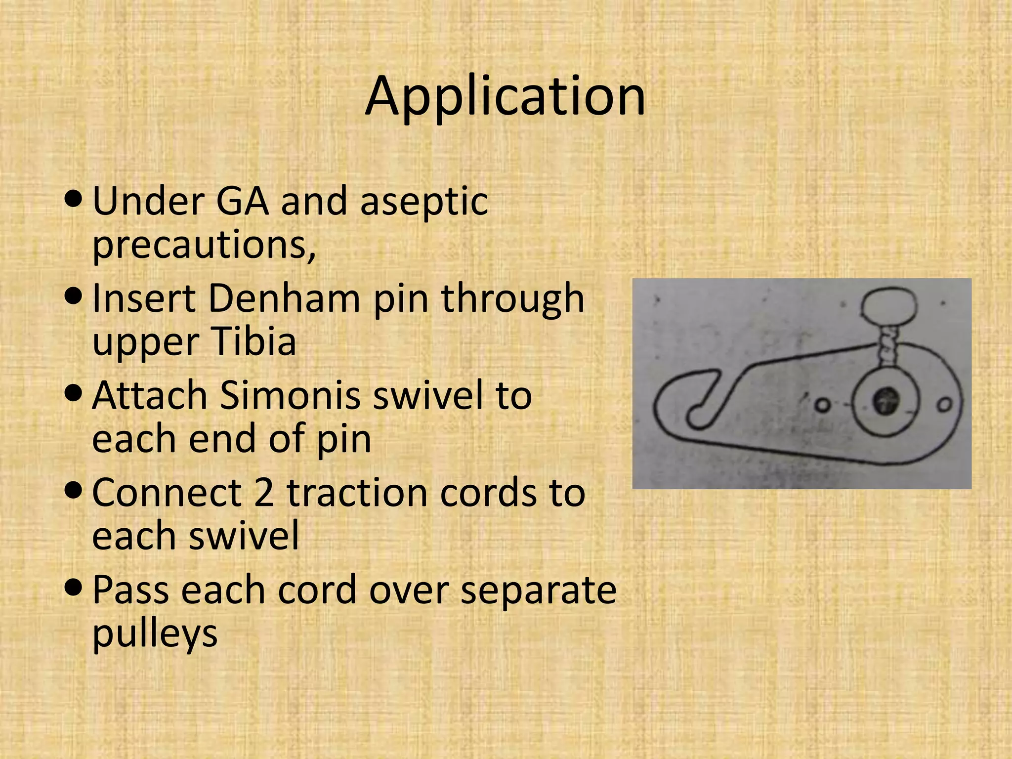 PPT ON TRACTIONS IN ORTHOPAEDICS | PPTX