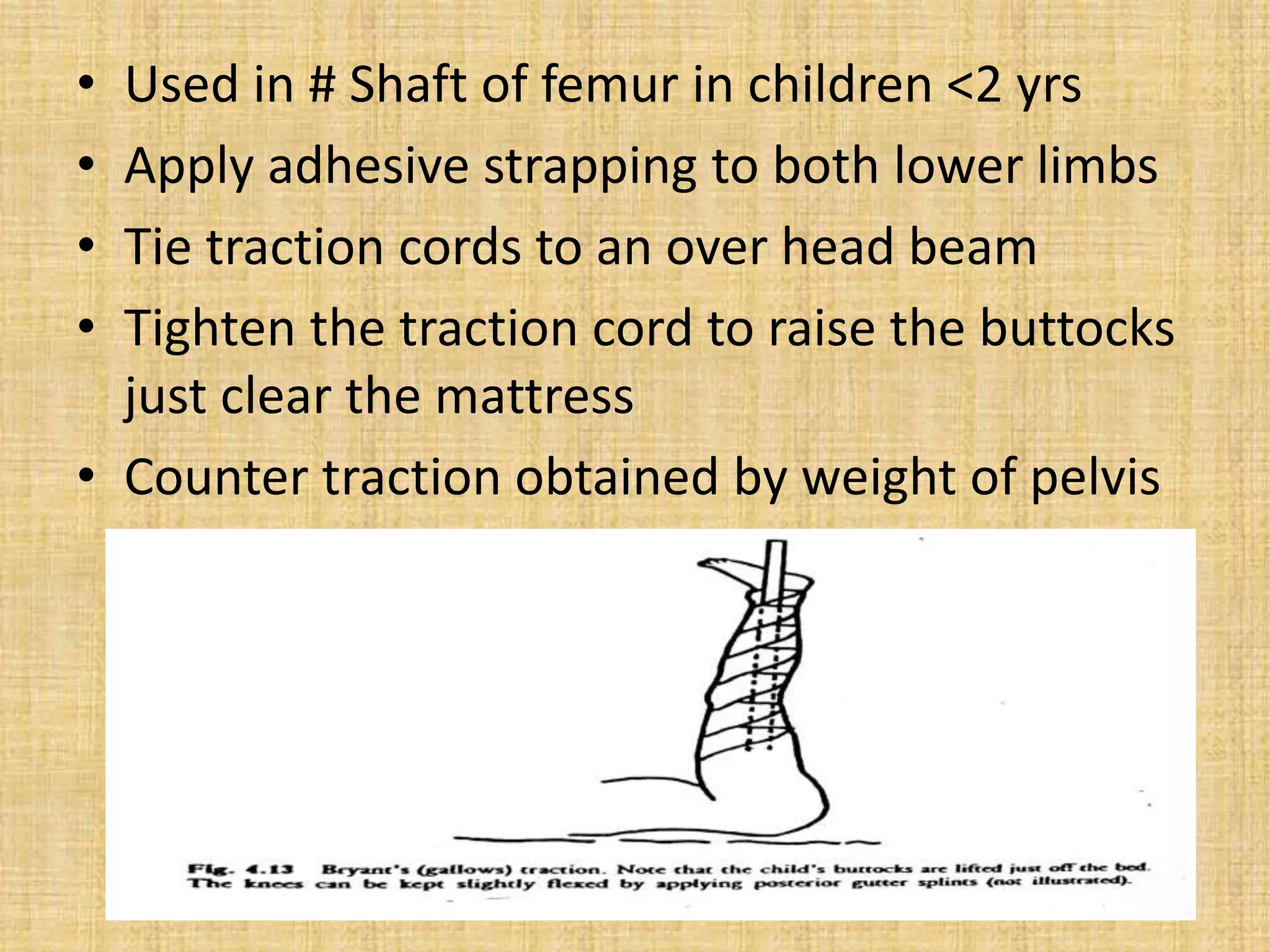 PPT ON TRACTIONS IN ORTHOPAEDICS | PPTX