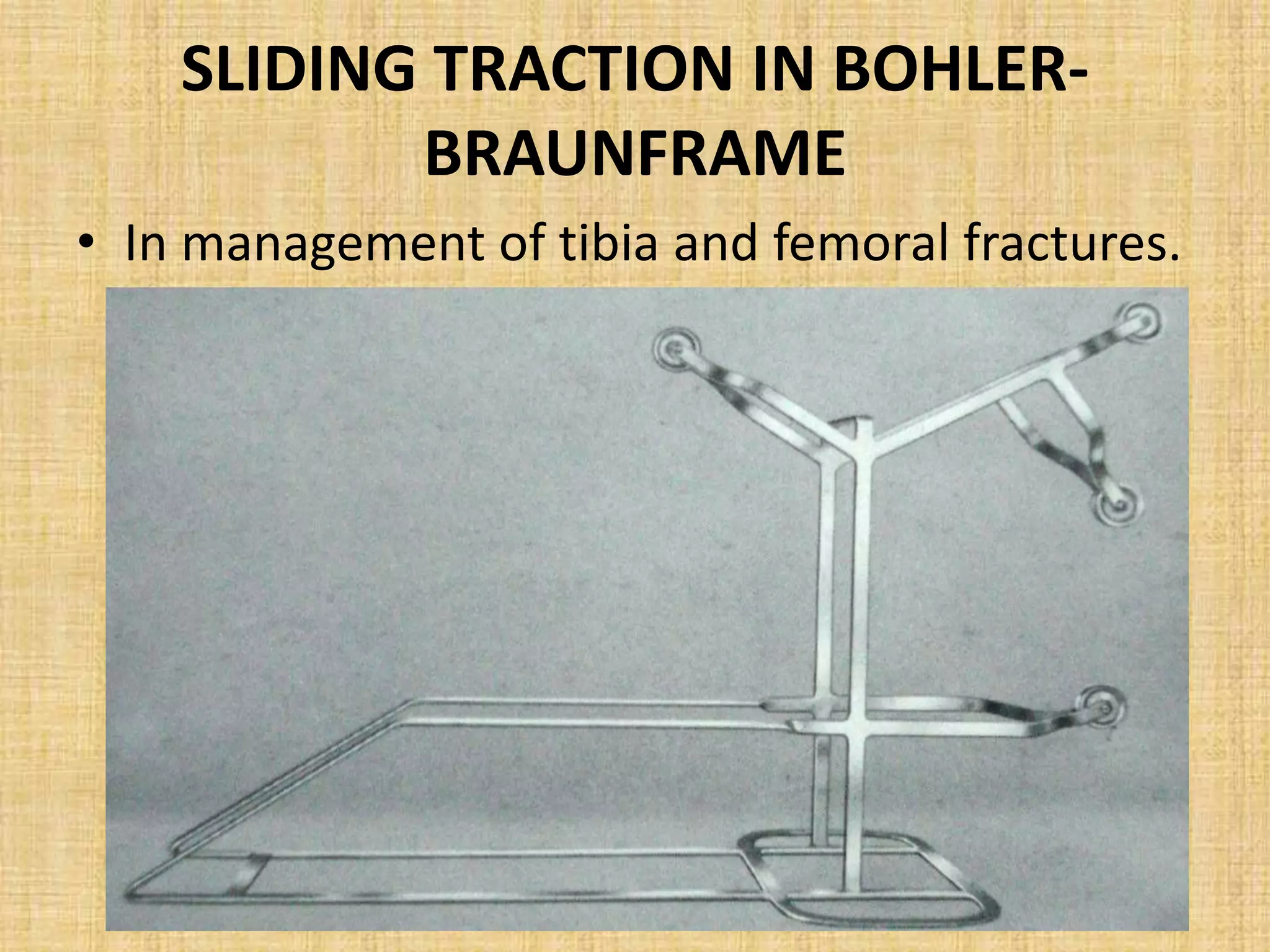 PPT ON TRACTIONS IN ORTHOPAEDICS | PPTX