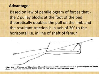 PPT ON TRACTIONS IN ORTHOPAEDICS | PPTX