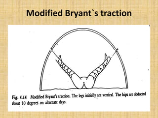 Bryants Traction