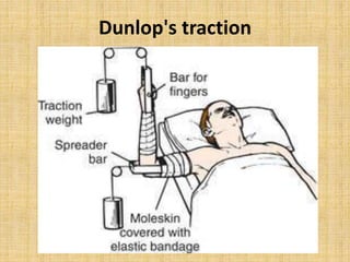 Dunlops Traction