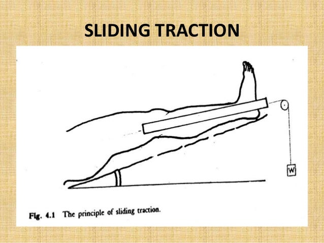 PPT ON TRACTIONS IN ORTHOPAEDICS