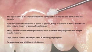 Dental calculus | PPTX