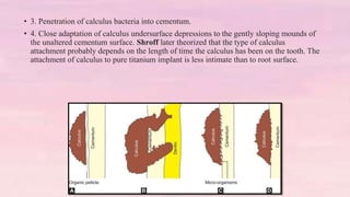 Dental calculus | PPTX
