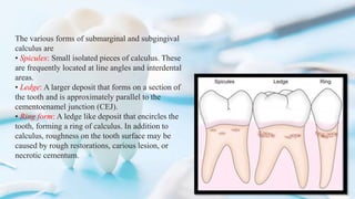 Dental calculus | PPTX