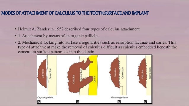 Dental calculus