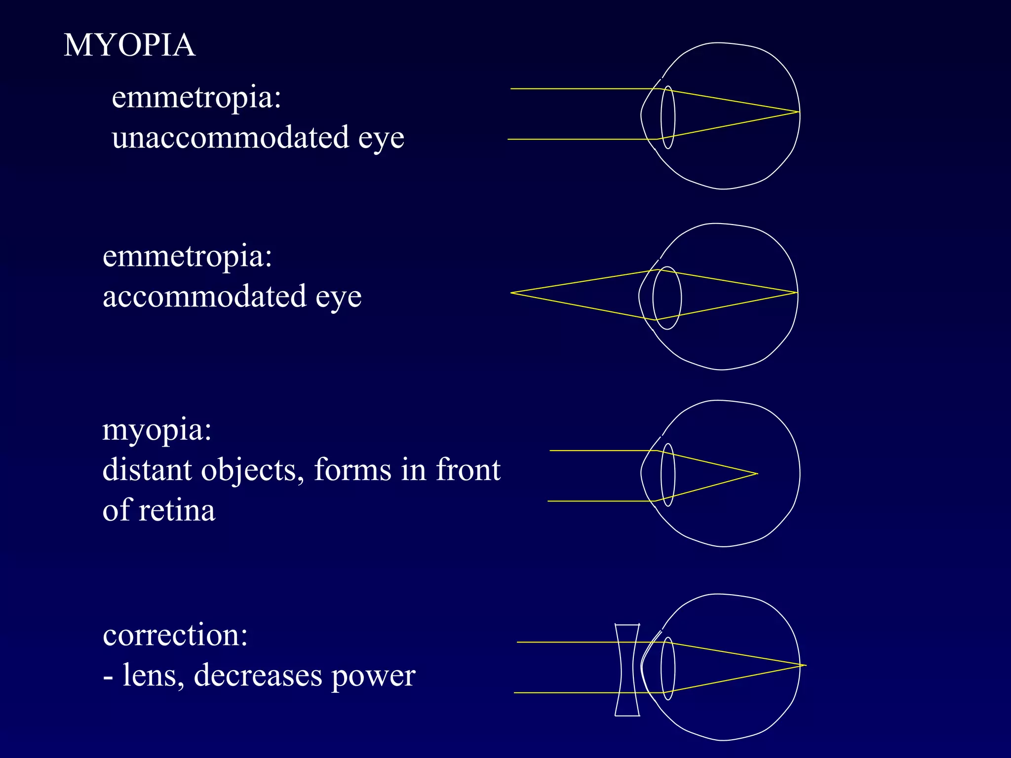 Vision | PPT | Eye and Vision Conditions | Diseases and Conditions