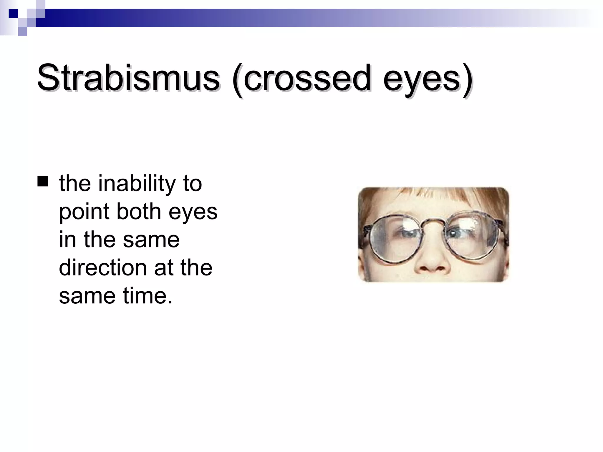 vision therapy | PPT