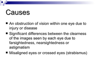 vision therapy | PPT