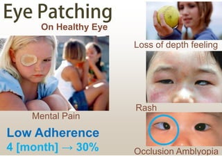 An innovative Amblyopia treatment methodology | PPT