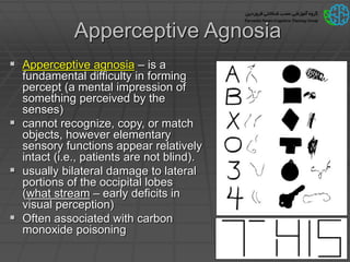 Apperceptive Agnosia