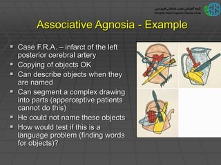 Apperceptive Agnosia