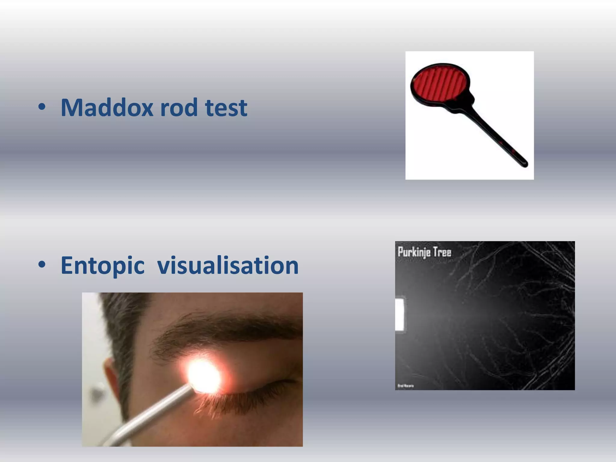 Vision assessment | PPTX
