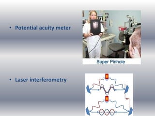 Vision assessment | PPTX
